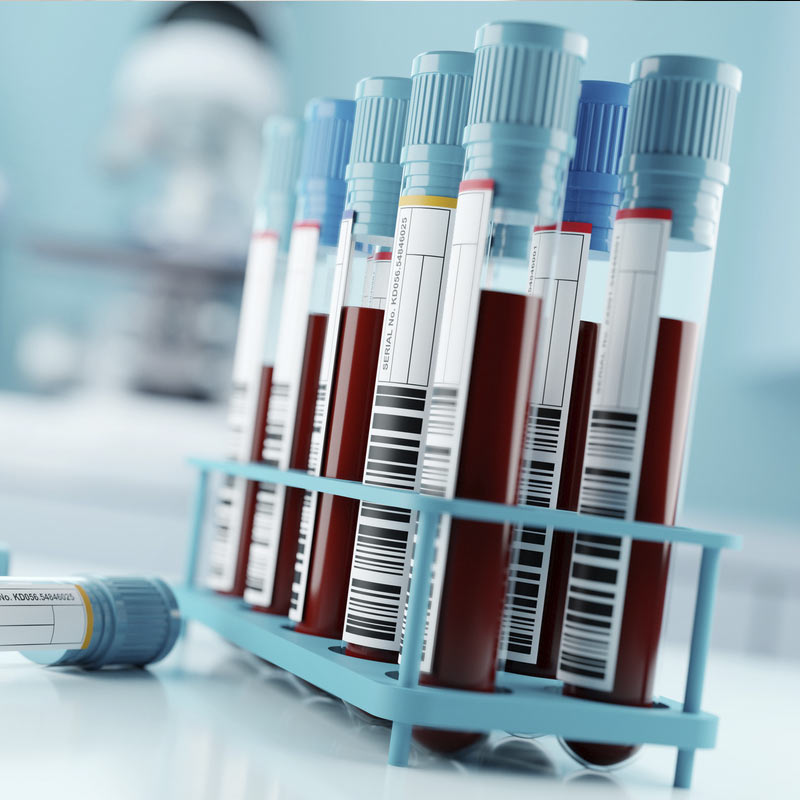 Guide to Dialysis and Kidney Disease - Aging.com